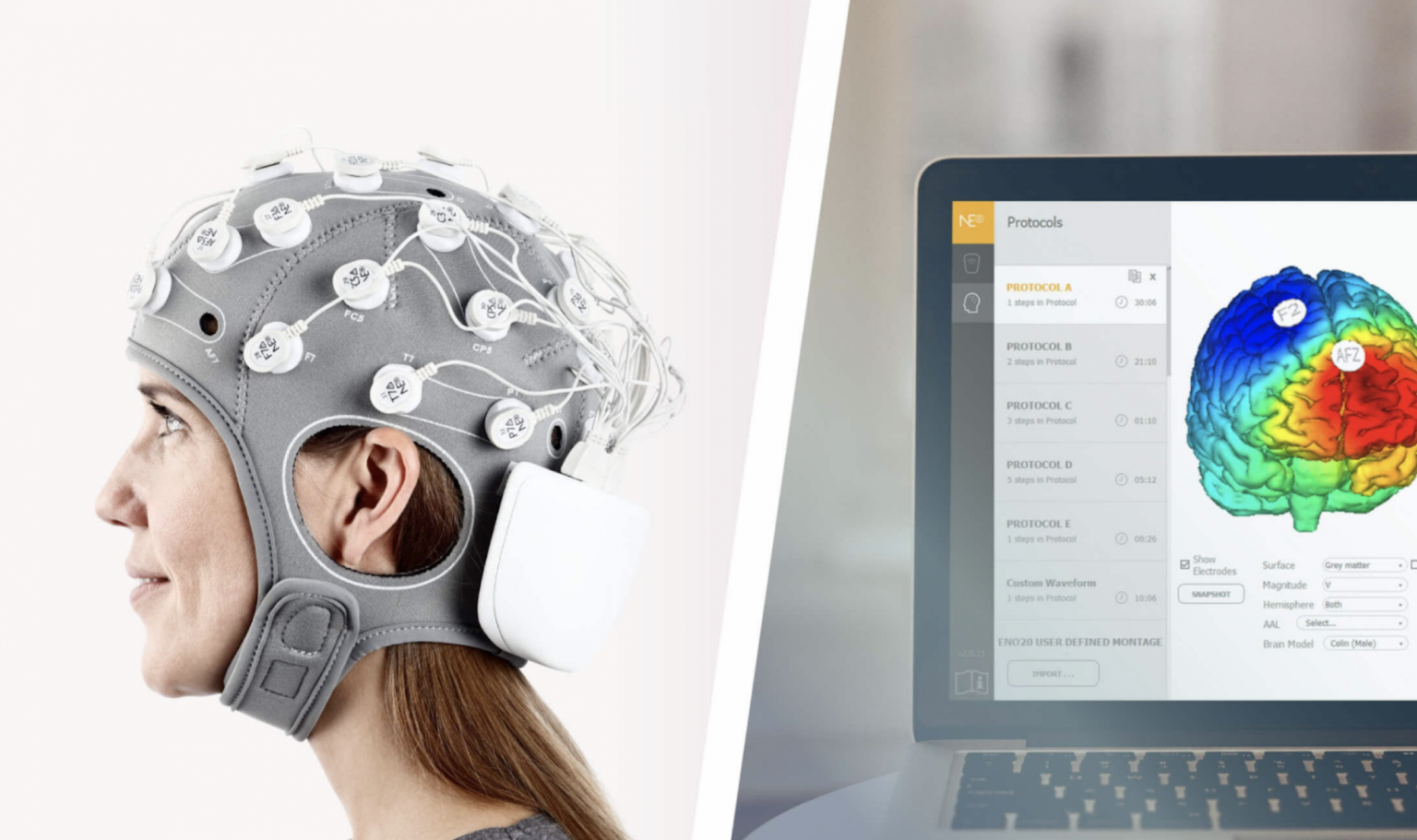 Neuroelectrics raises $17.5m to transform epilepsy treatment | Sifted
